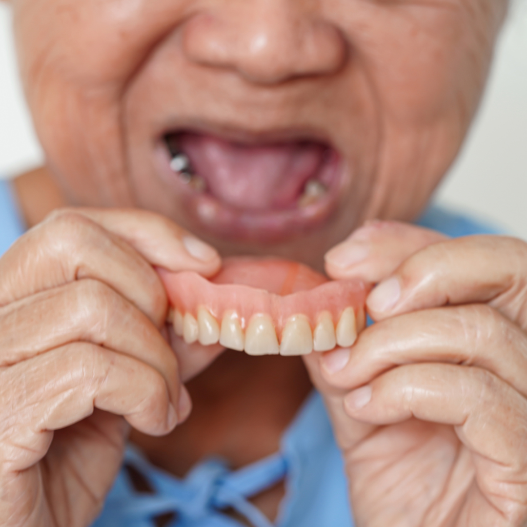 Best Complete Dentures in Hyderabad | Custom-Made & Affordable
